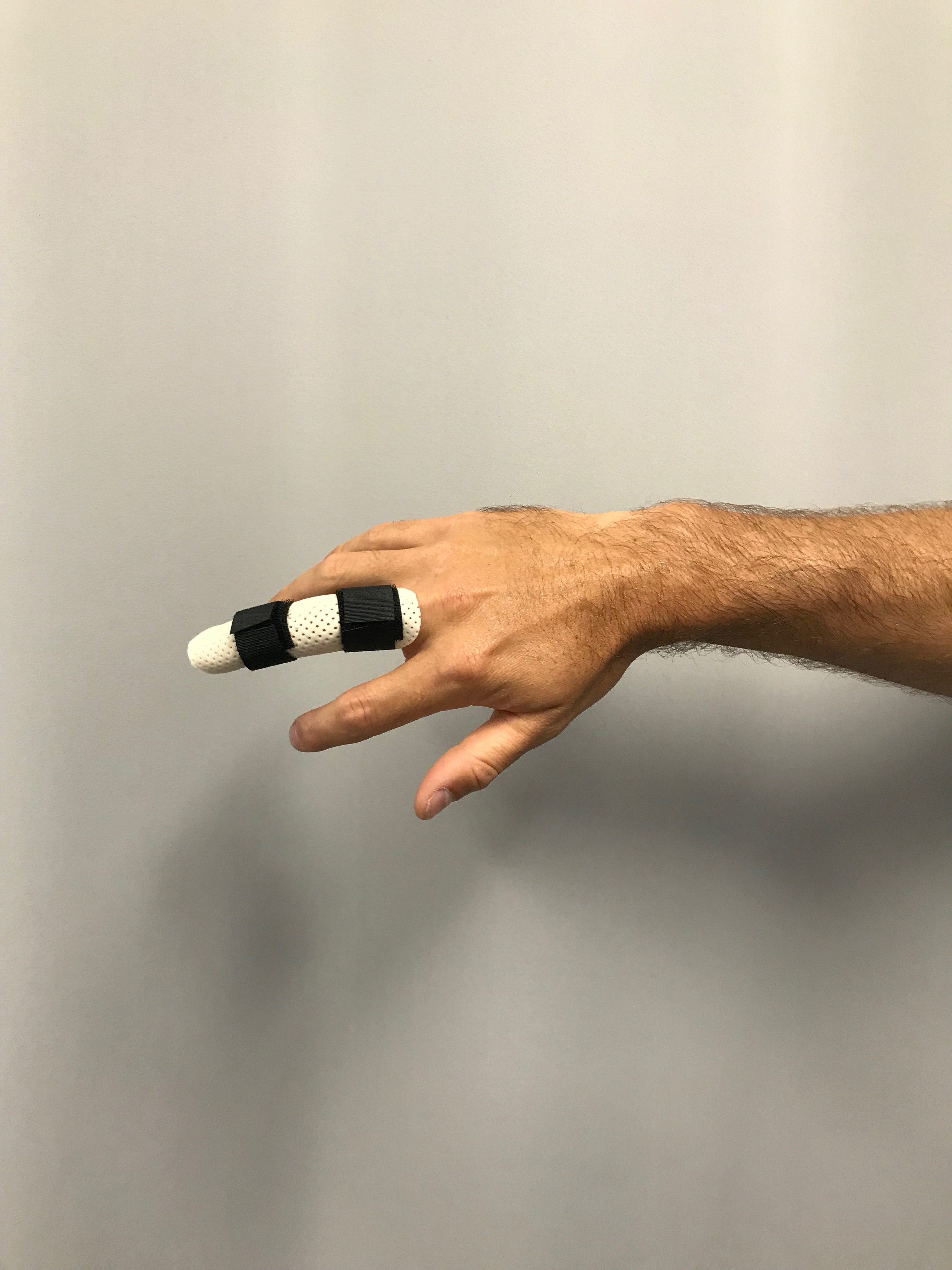 Finger Fractures – Coast Sport