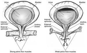 Pelvic Floor & Incontinence Care - Central Coast Physiotherapy